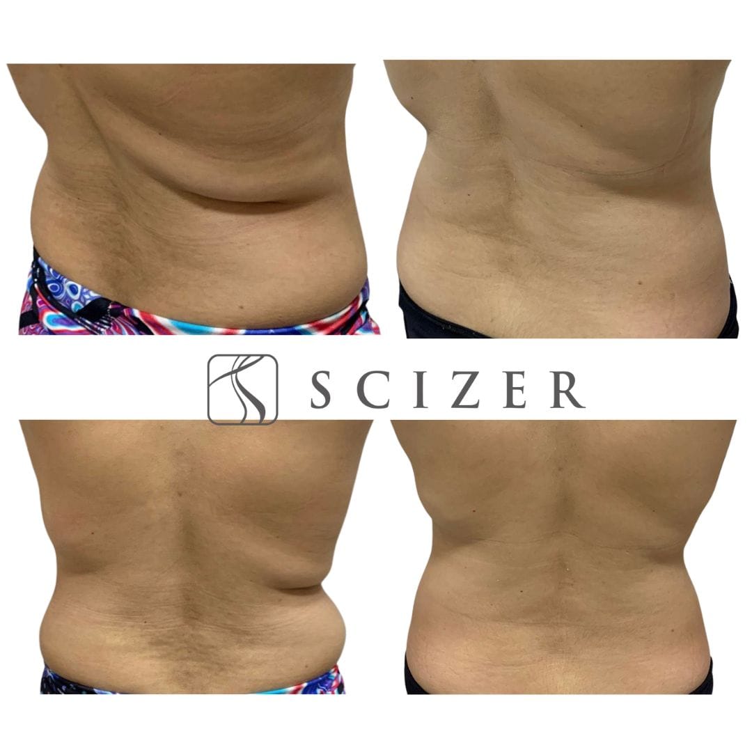 LP 2023 – Scizer – Clínica Soul+